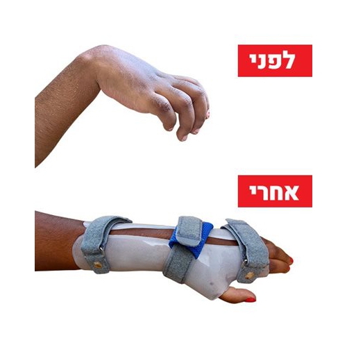 Silicone Wirst Hand Ortho | Hand-Finger Orthoses